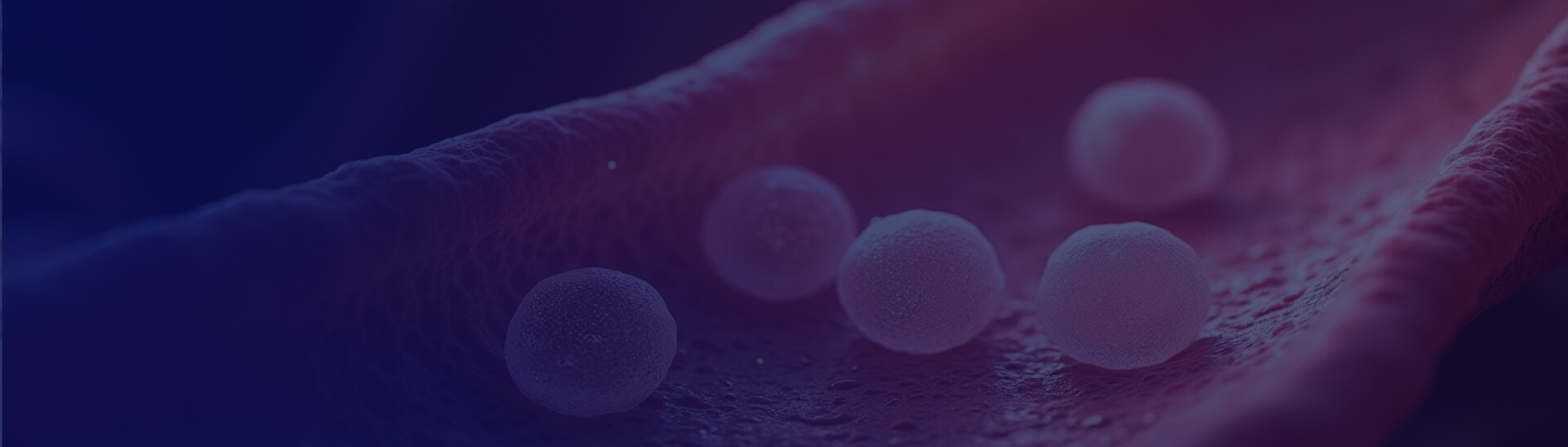 Non-Hodgkin Lymphoma (NHL) - Adults | Sheba Medical Center